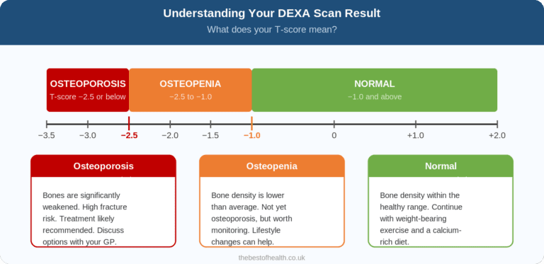Compare the Cost of a DEXA Bone Density Scan in the UK (2026) - The ...